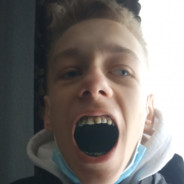 Steam Community :: YAKINDER