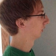 Steam Community :: ronald